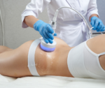 Best Non-Invasive Weight Loss Procedures & Treatments